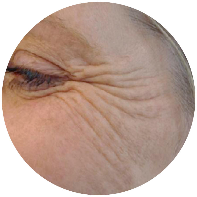 Sagging Skin | Dr. Kyo Clinic - Top Aesthetic Clinic Malaysia